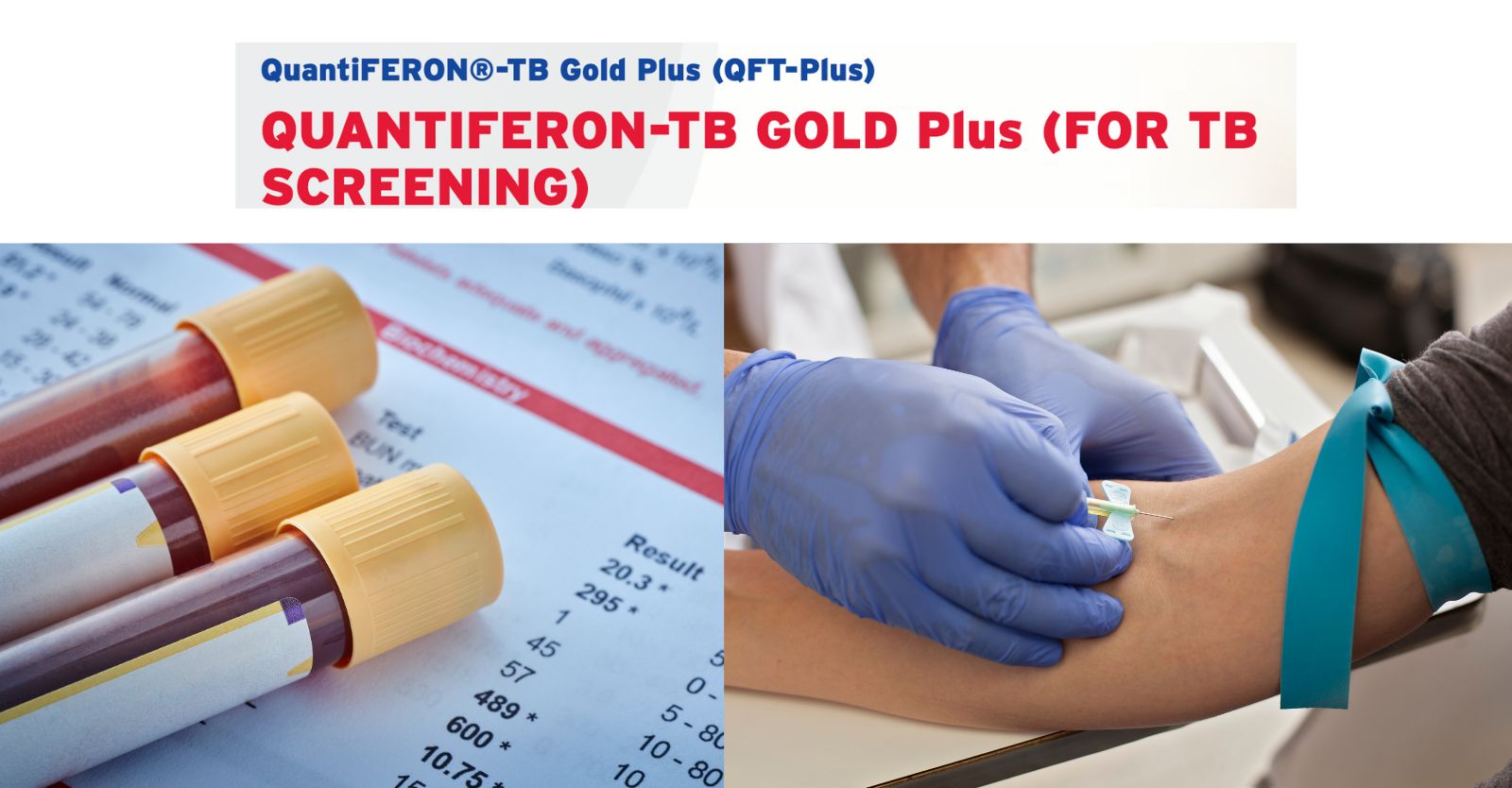 Tuberculosis (TB) Testing for Healthcare Workers: YOU HAVE OPTIONS ...